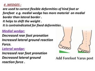 FYBPO - Orthotics - AIIPMR Lectures. | PPT