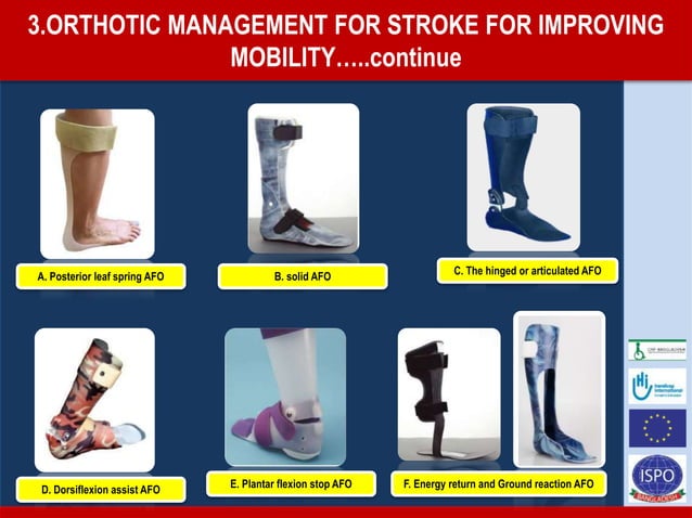 Orthotic management of stroke for mobility --- Madeshanaika (India) | PPTX