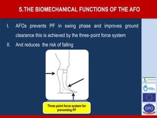 Orthotic management of stroke for mobility --- Madeshanaika (India) | PPTX