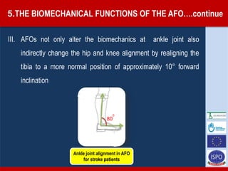 Orthotic management of stroke for mobility --- Madeshanaika (India) | PPTX
