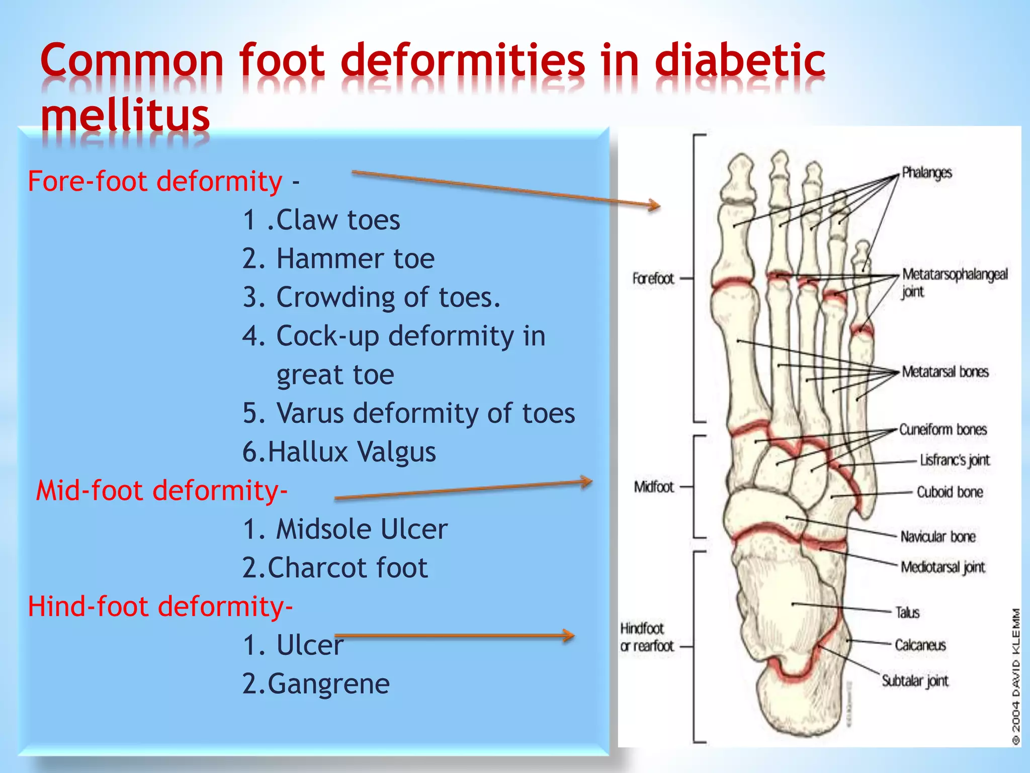 Orthotic management of diabetes mellitus foot | PPTX