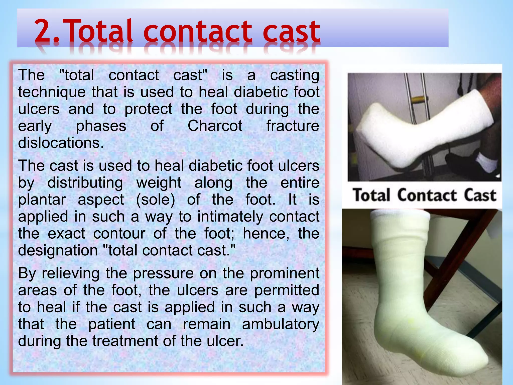 Orthotic management of diabetes mellitus foot | PPTX
