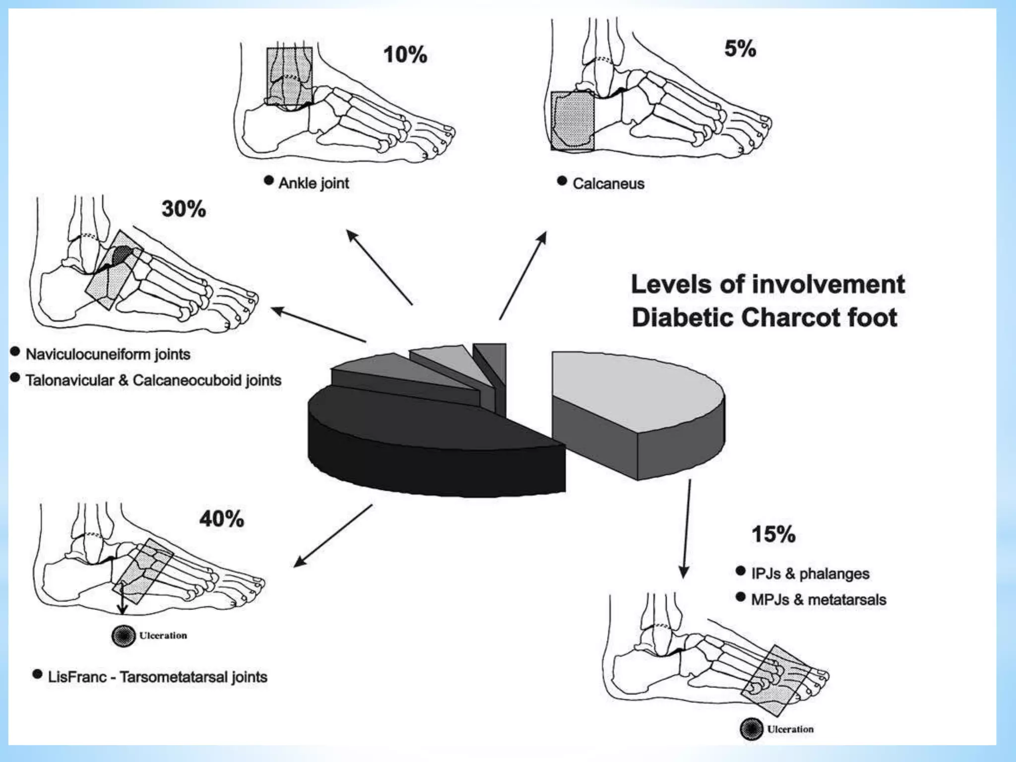 Orthotic management of diabetes mellitus foot | PPTX