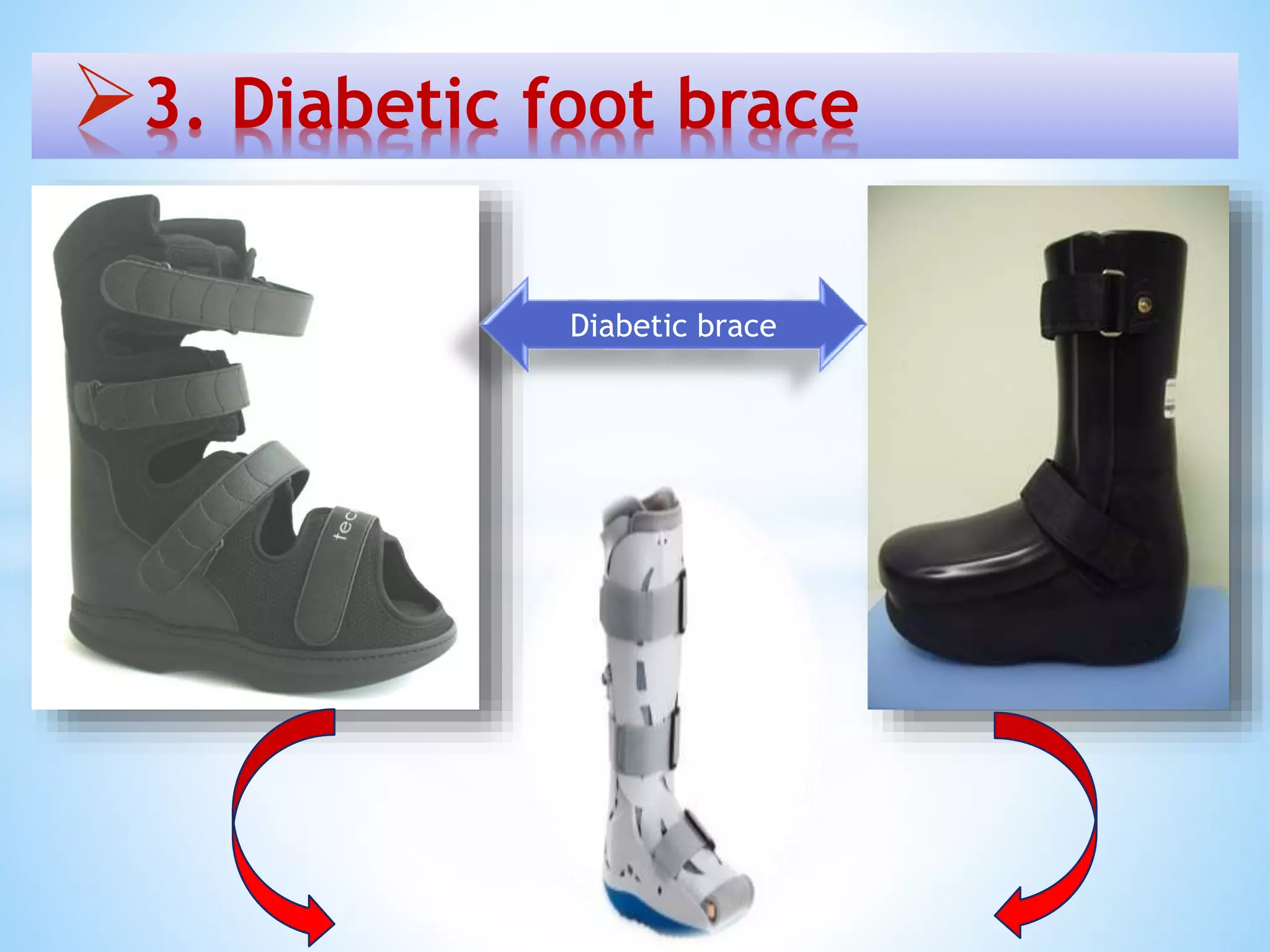 Orthotic management of diabetes mellitus foot | PPTX