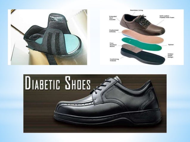 Orthotic management of diabetes mellitus foot | PPTX