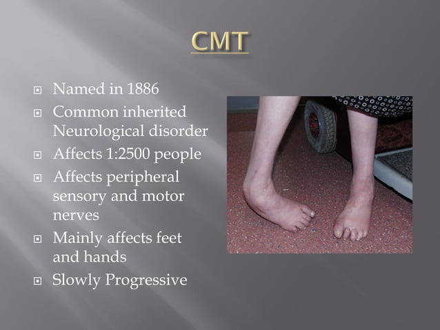 Orthotic Management of Charcot Marie Tooth | PDF | Physical Therapy ...