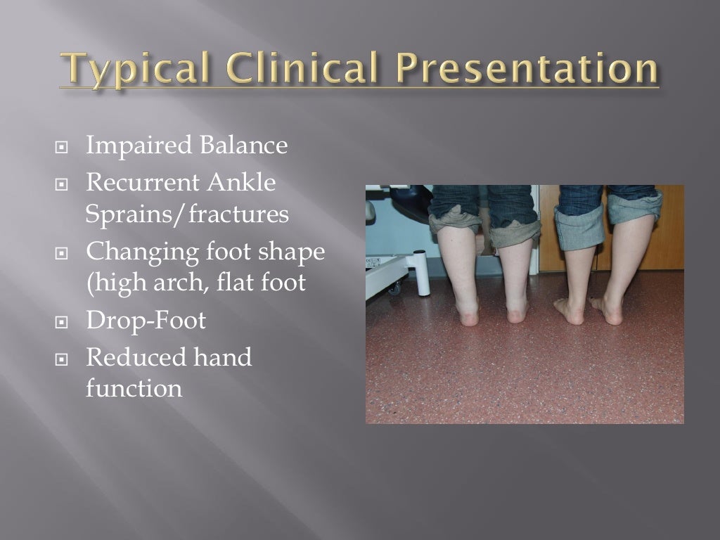 Orthotic Management of Charcot Marie Tooth