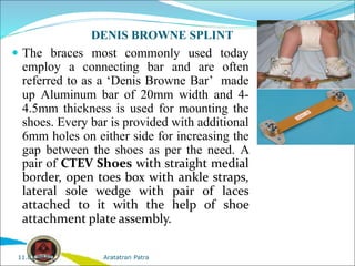 Orthotic Management of CTEV-A.Patra | PPSX