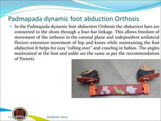 Orthotic Management of CTEV-A.Patra | PPSX
