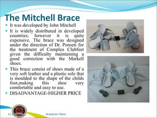 Orthotic Management of CTEV-A.Patra | PPSX