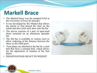 Orthotic Management of CTEV-A.Patra | PPSX