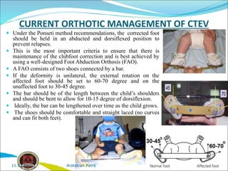 Orthotic Management of CTEV-A.Patra | PPSX