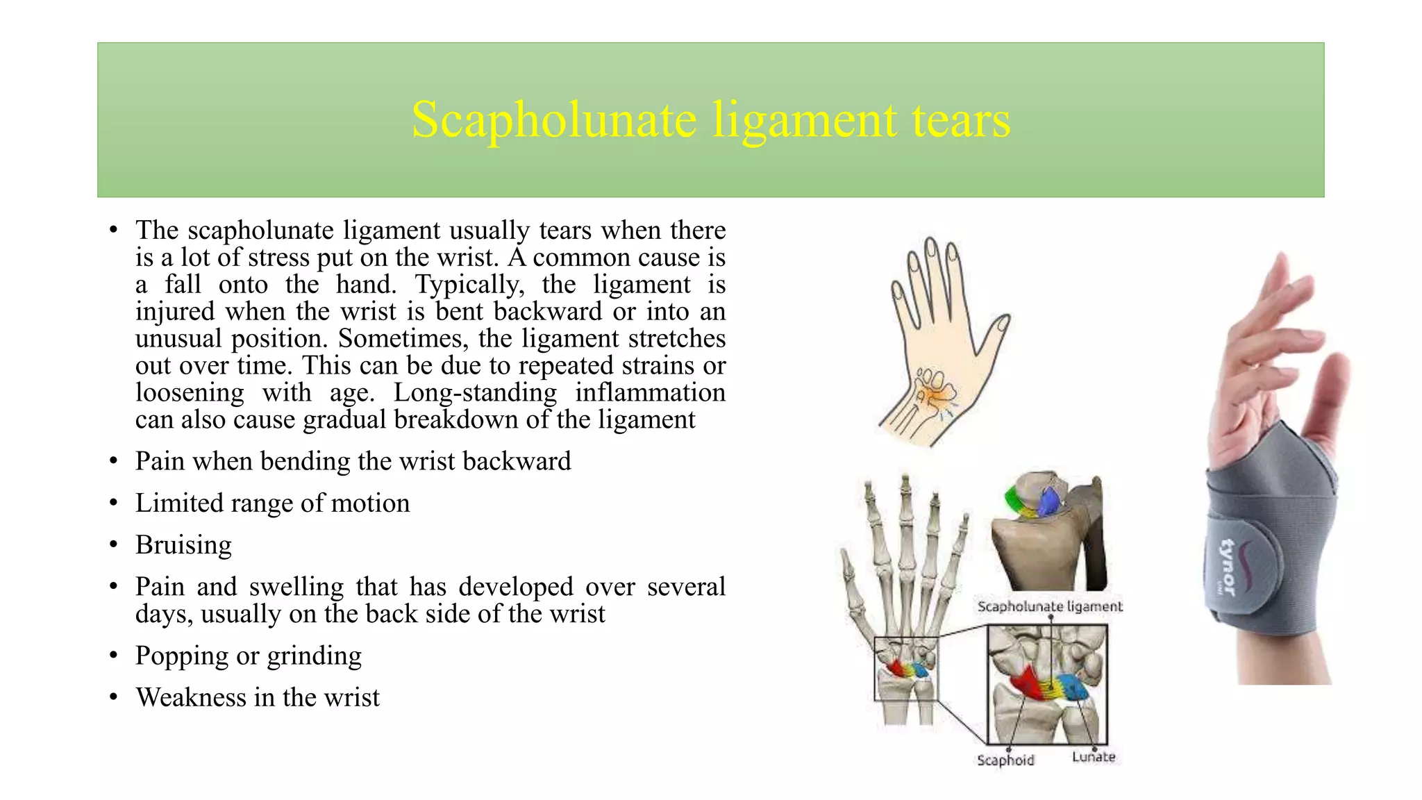 Orthotic management of Elbow joint, Wrist Joint.pptx