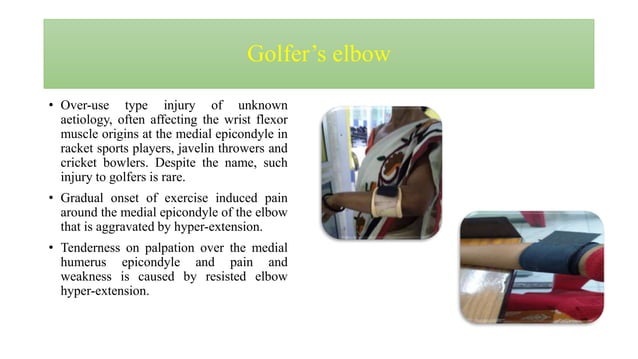Orthotic management of Elbow joint, Wrist Joint.pptx