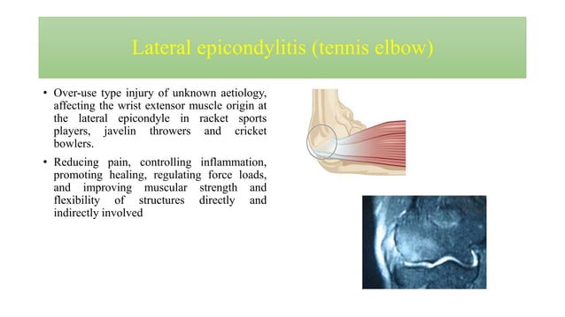 Orthotic management of Elbow joint, Wrist Joint.pptx