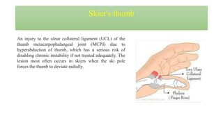 Orthotic management of Elbow joint, Wrist Joint.pptx