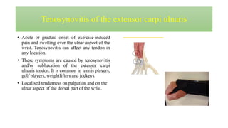 Orthotic management of Elbow joint, Wrist Joint.pptx