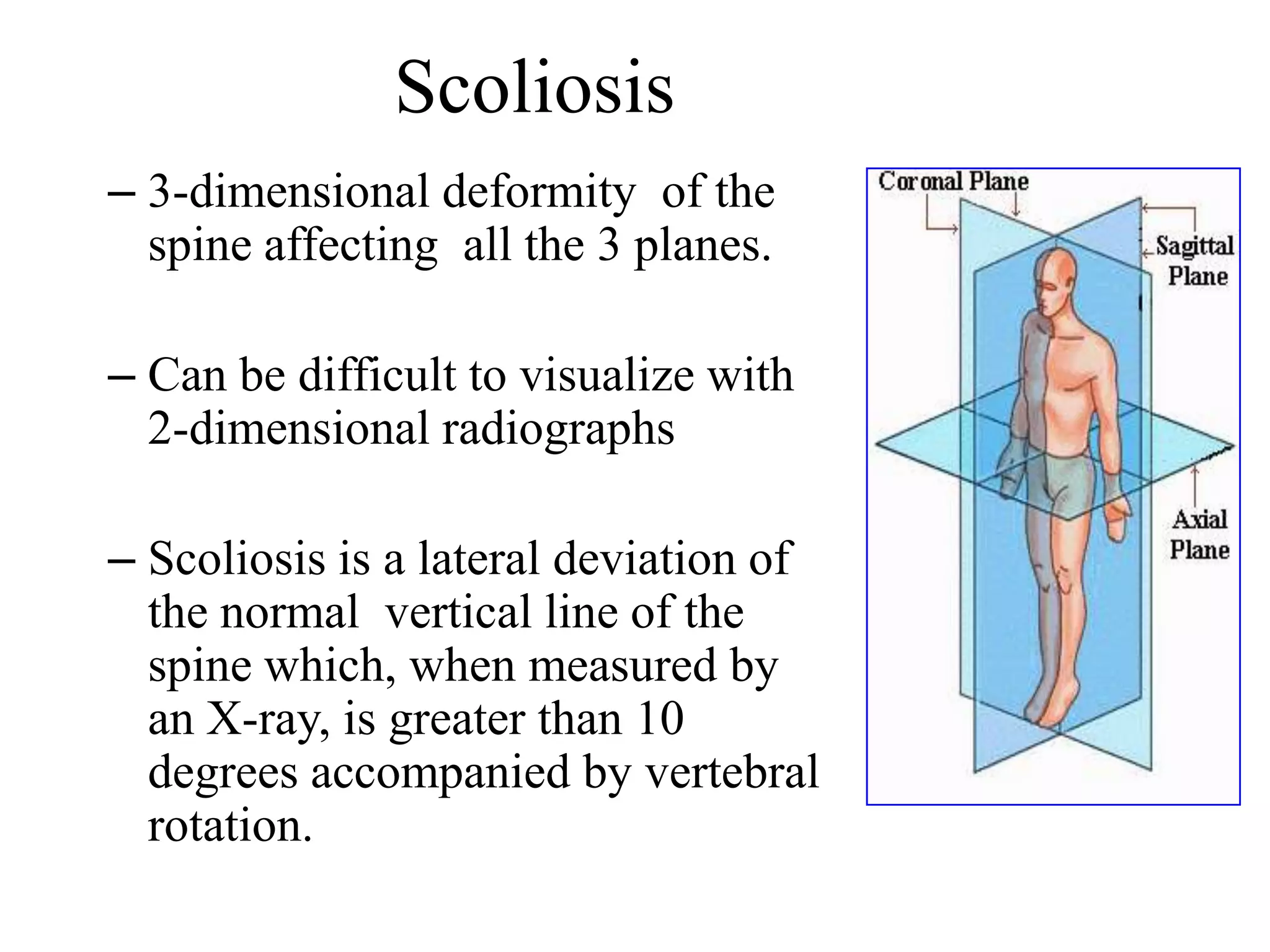 Orthotic management of scoliosis | PPTX