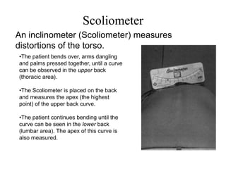 Orthotic management of scoliosis | PPTX