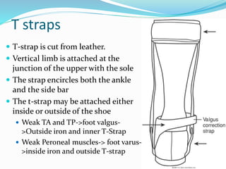 Orthotics | PPT