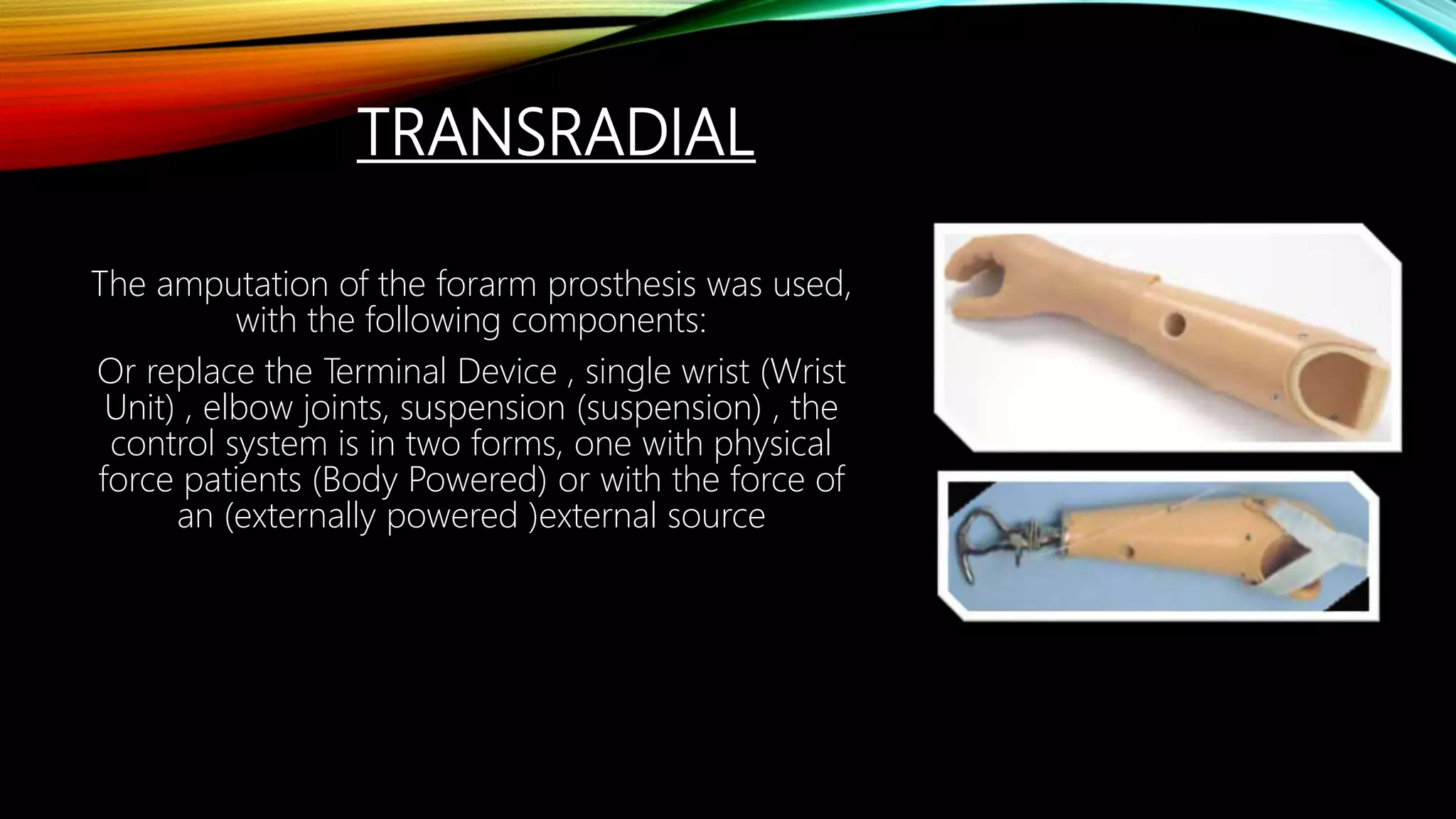 Orthotics and prosthetics | PPTX