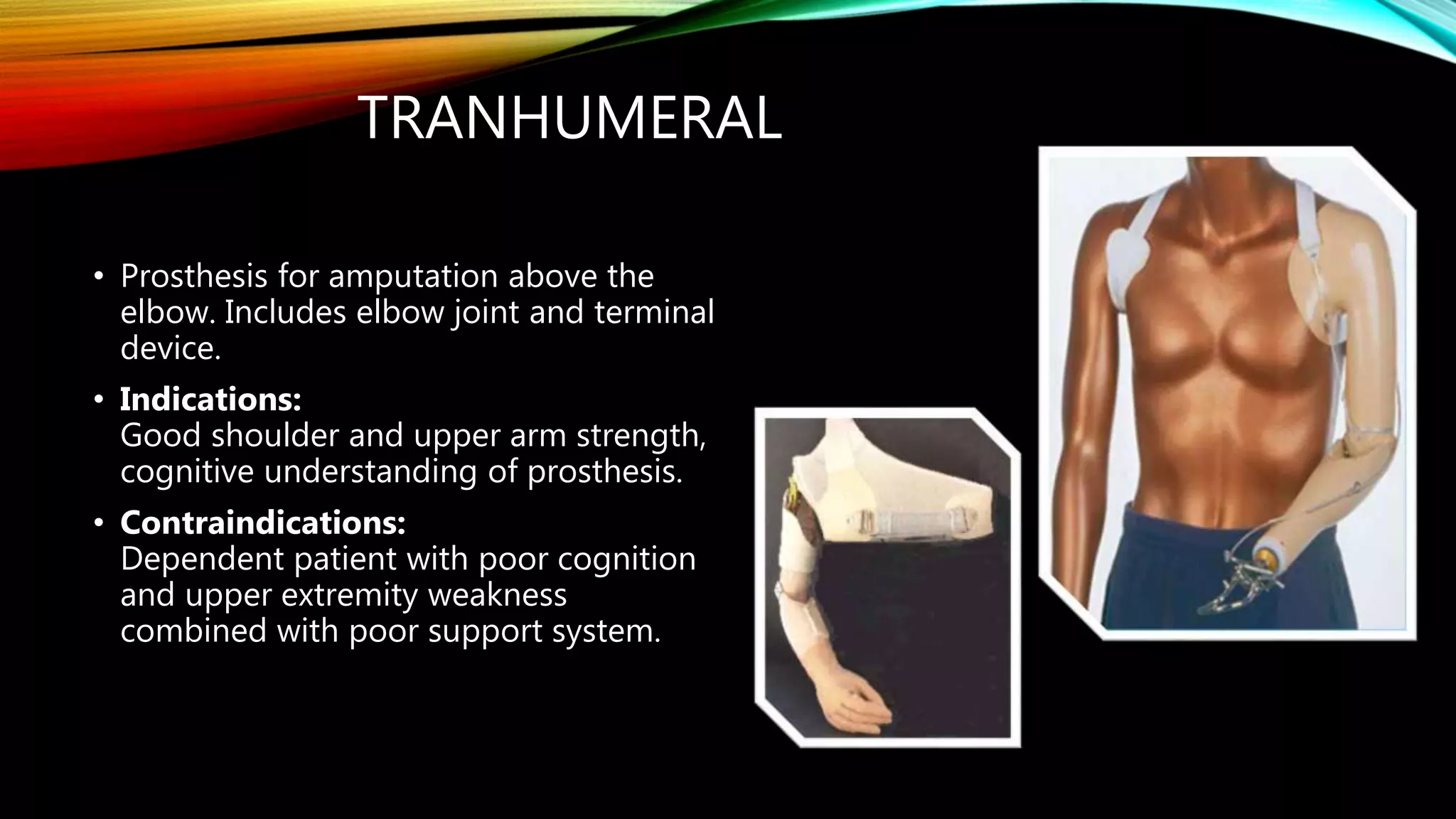 Orthotics and prosthetics | PPTX