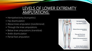 Orthotics and prosthetics | PPTX