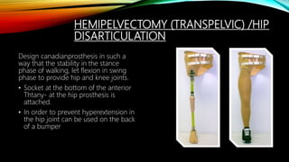 Orthotics and prosthetics | PPTX