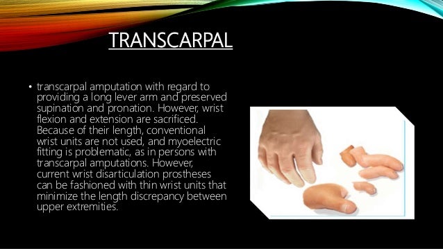 Orthotics and prosthetics