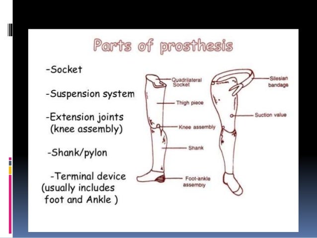 Orthotics and ptrosthetics