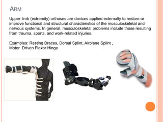Motor Driven Flexor Hinge Orthosis