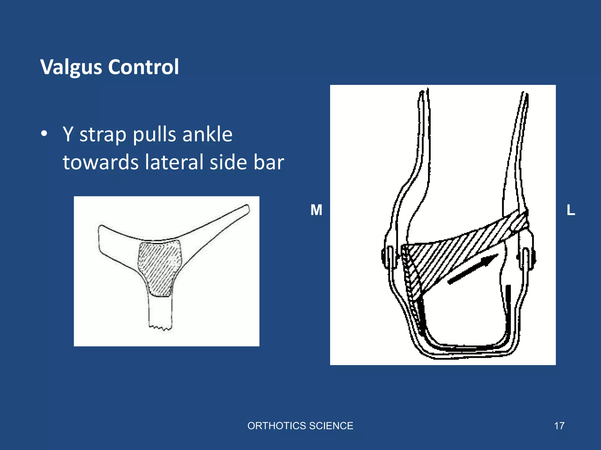 Orthotics Science edited AFOs (Conventional).ppt