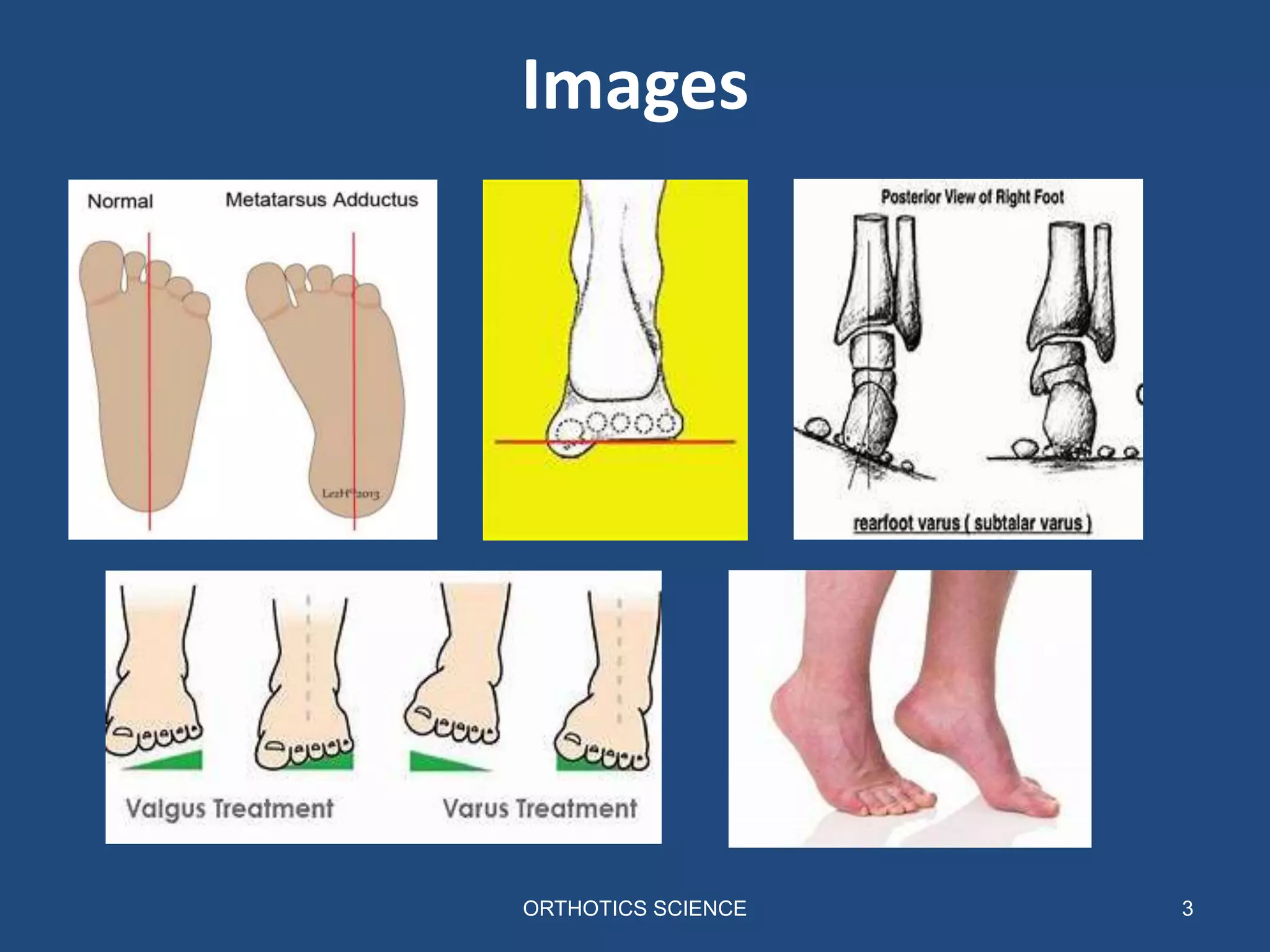Orthotics Science edited AFOs (Conventional).ppt