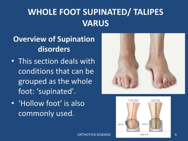 Orthotics Science edited AFOs (Conventional).ppt