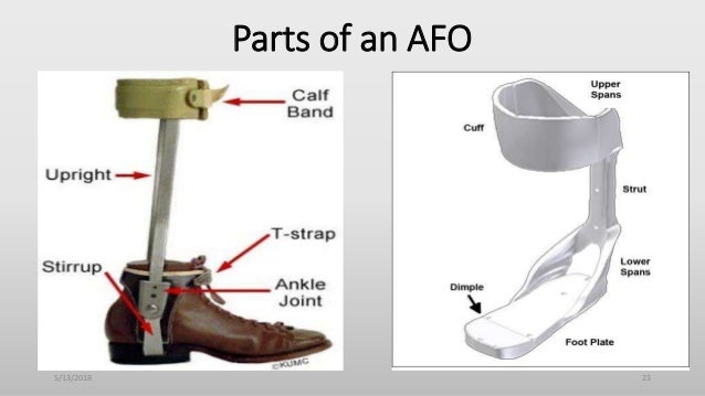 Orthotic treatment for cp patients (ridoy)