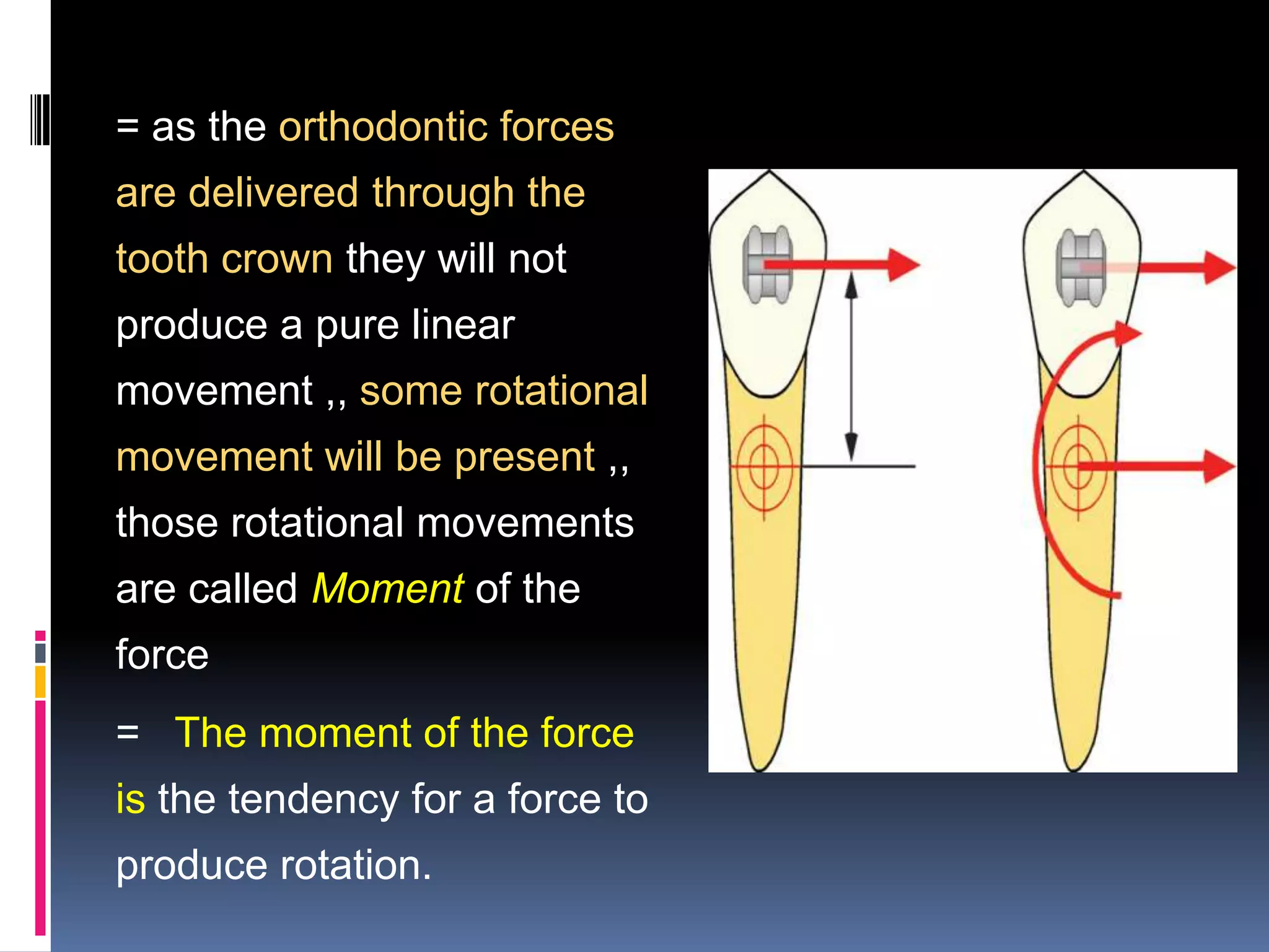 Orthodontic tooth movement ppt. | PPTX