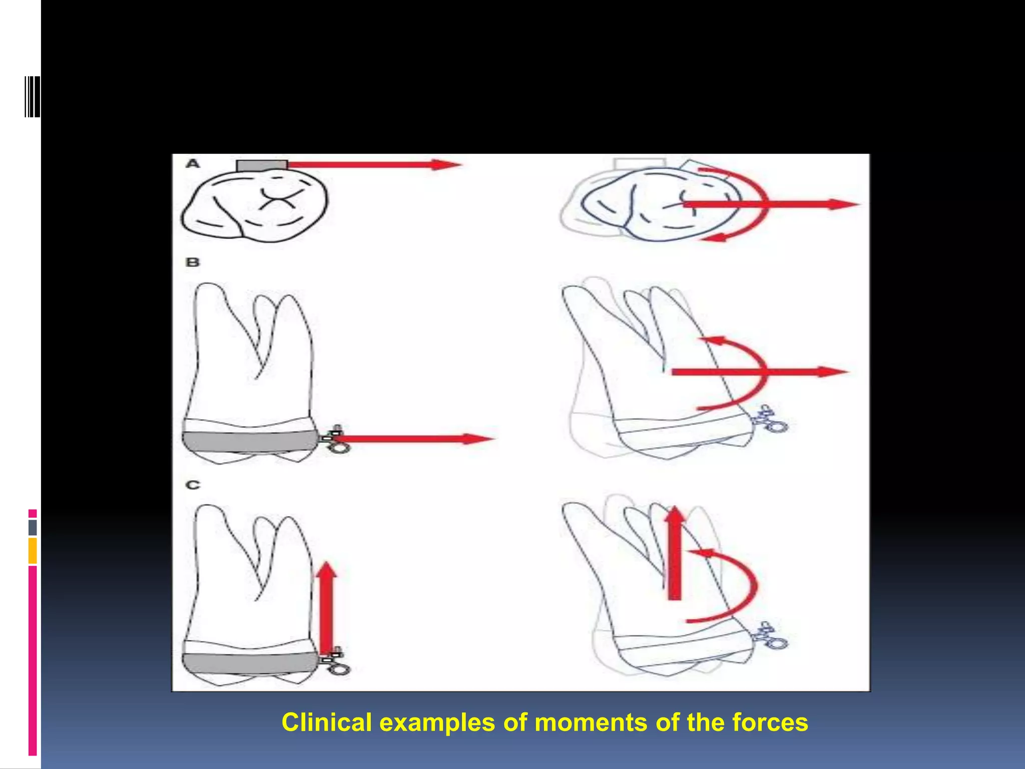 Orthodontic tooth movement ppt. | PPTX