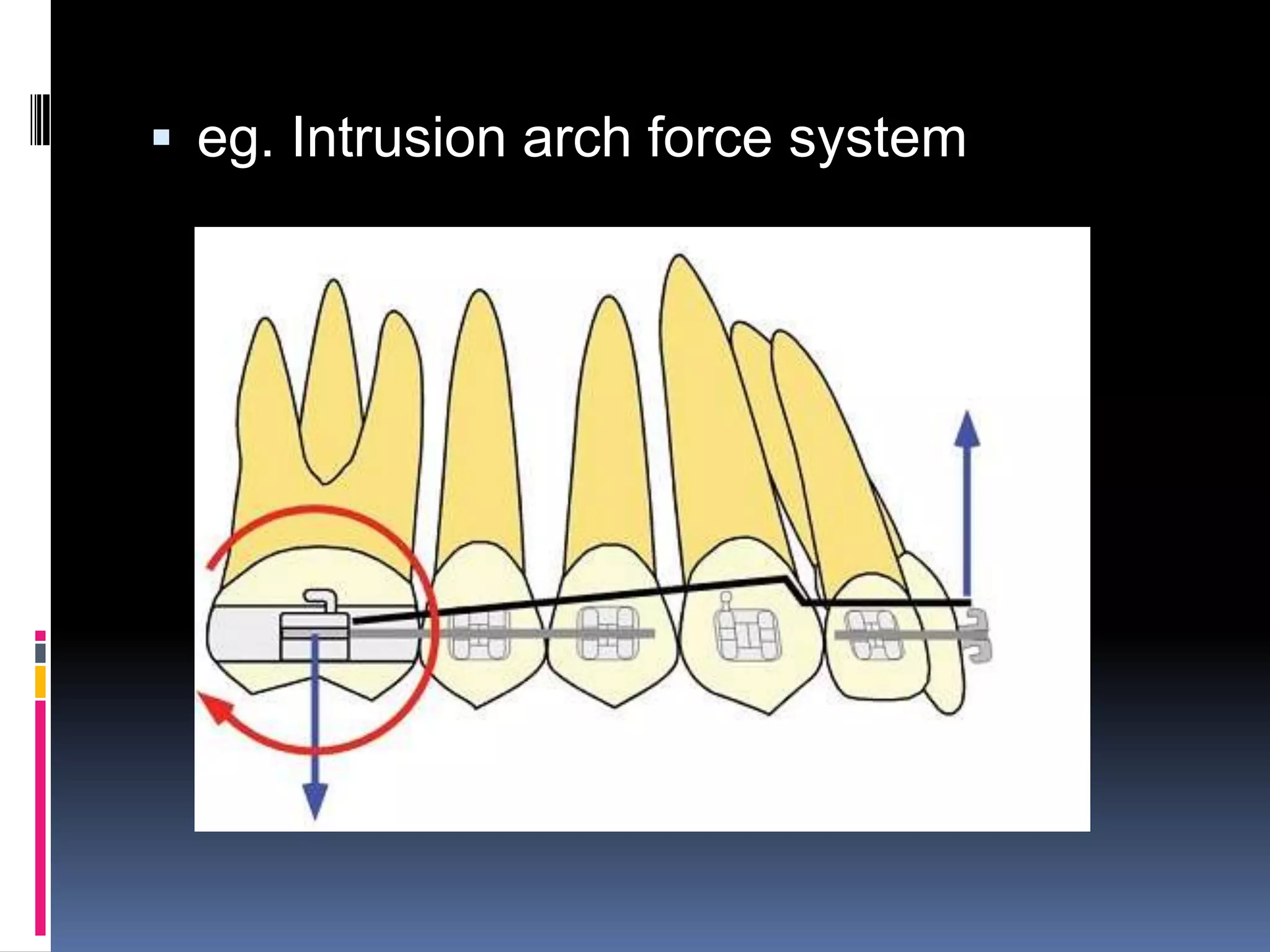 Orthodontic tooth movement ppt. | PPTX | Dental Health | Diseases and ...