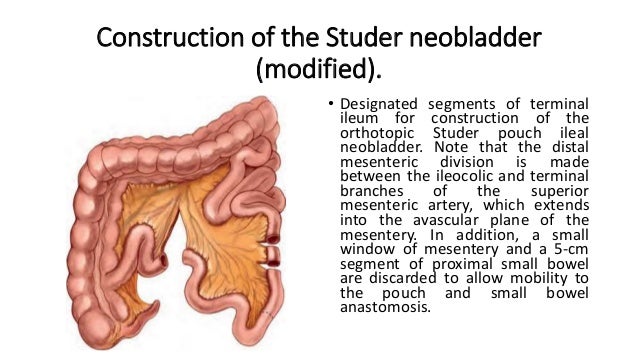 Orthotopic neobladder