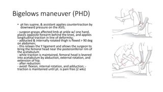 Hip Dislocations: Ortho topic presentation 2018 | PPTX