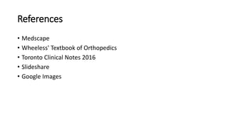 Hip Dislocations: Ortho topic presentation 2018 | PPT