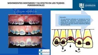 relaciones Ortodoncia y periodoncia y la importancia del manejo ...