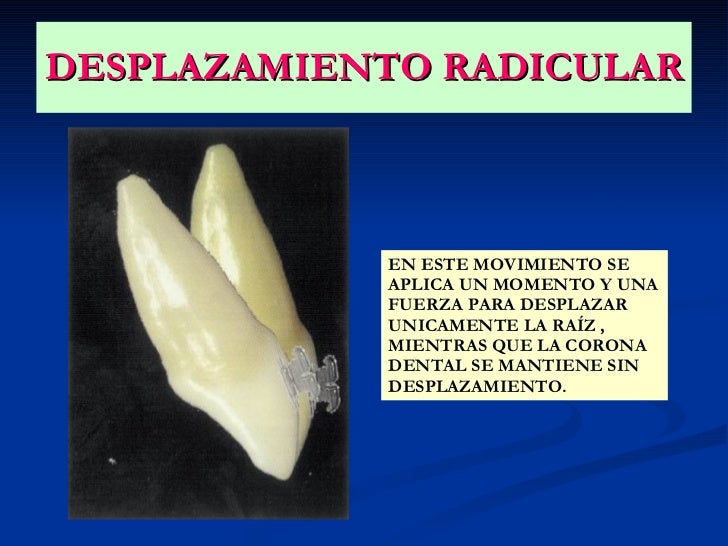 Radicular Significado