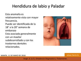ORTODONCIA- ETIOLOGIA DE LA MALOCLUSION.pptx