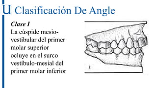 ORTODONCIA FIJA Y REMOVIBLE - CLASE 5- MALOCLUSIONES.pptx