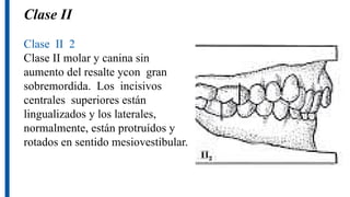 ORTODONCIA FIJA Y REMOVIBLE - CLASE 5- MALOCLUSIONES.pptx
