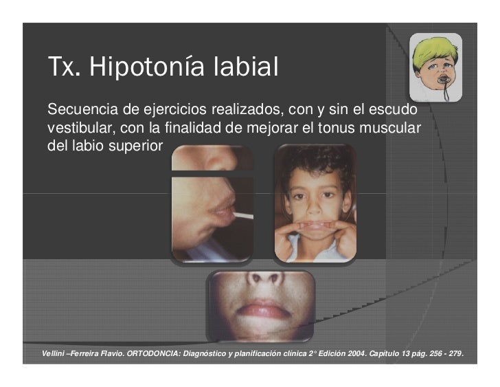 Ortodoncia interceptiva