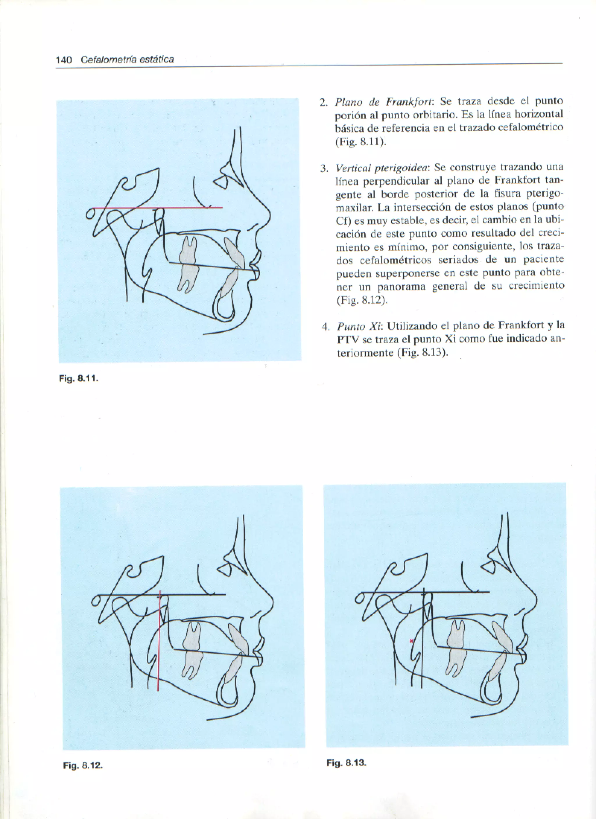Ortodoncia y cirugia ortognatica. gregoret cap 8 | PDF
