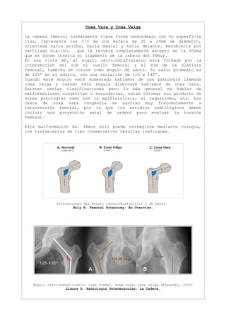 Ortopedia femur | PDF