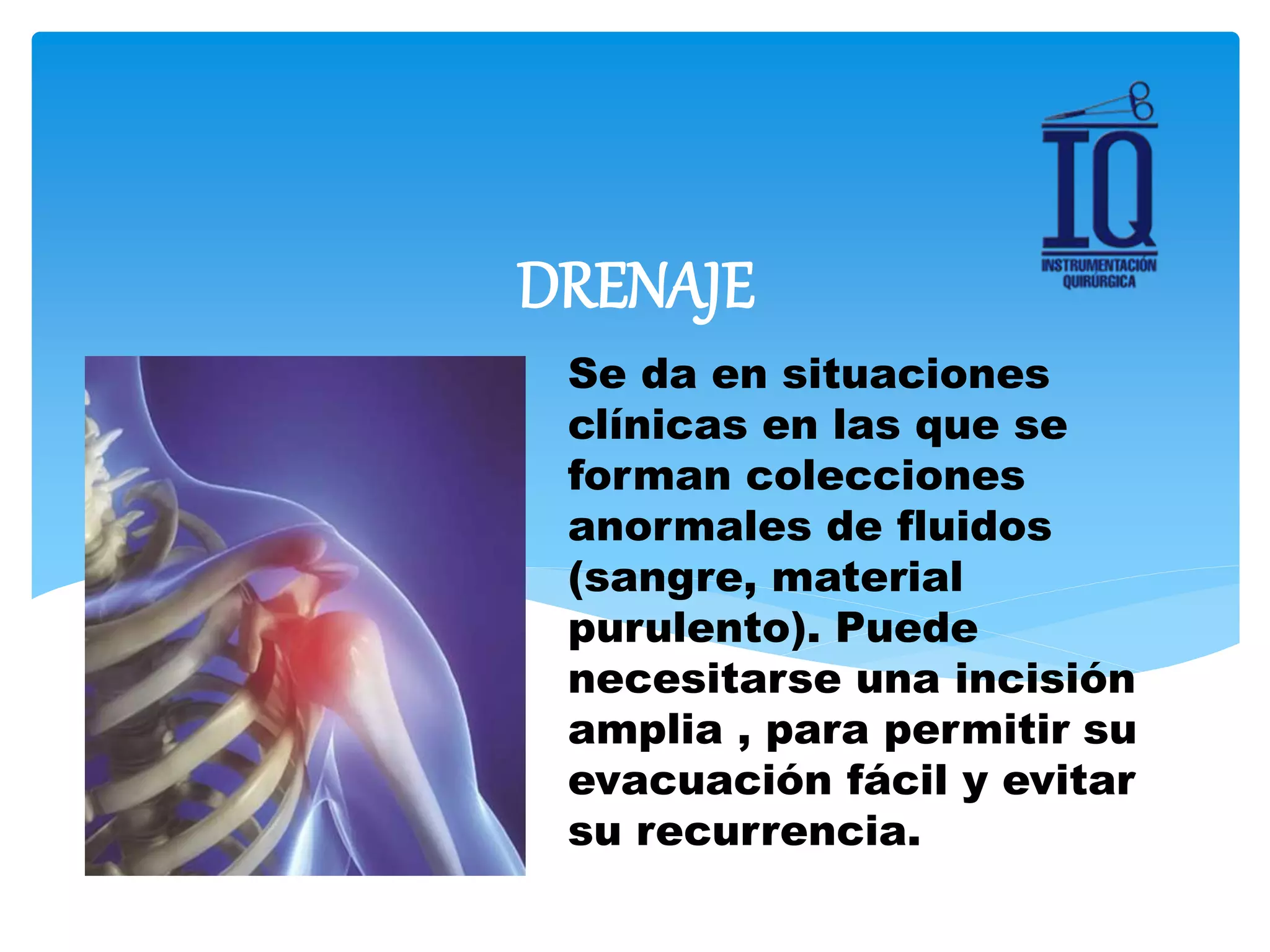 Ortopedia generalidades | PPTX